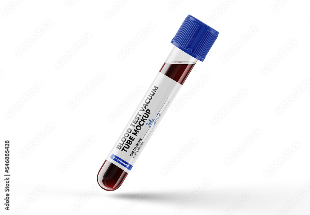 Blood Test Mockup Stock Template | Adobe Stock