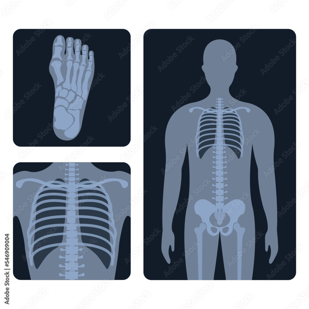 Medical radiology. Different x-ray or radiographic images of human body ...