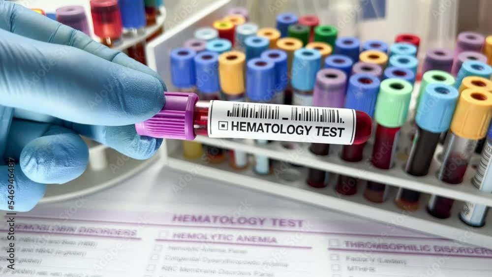 Technician lab with Blood testing over requisition report for ...