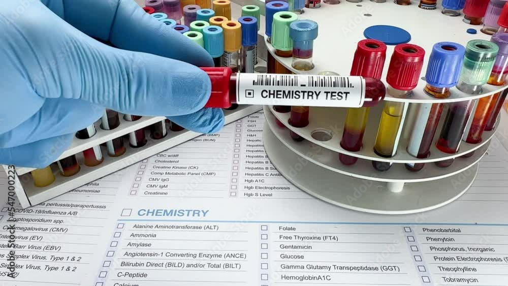 Doctor holding Blood sample tube for analysis of blood chemistry study ...