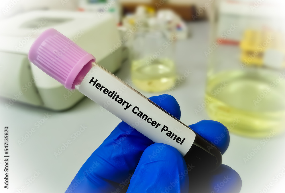 Blood sample for hereditary cancer panel test, including the detection ...