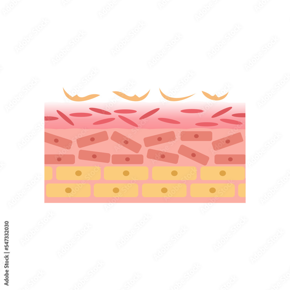 vector illustration of human skin structure anatomy. broken and dry ...