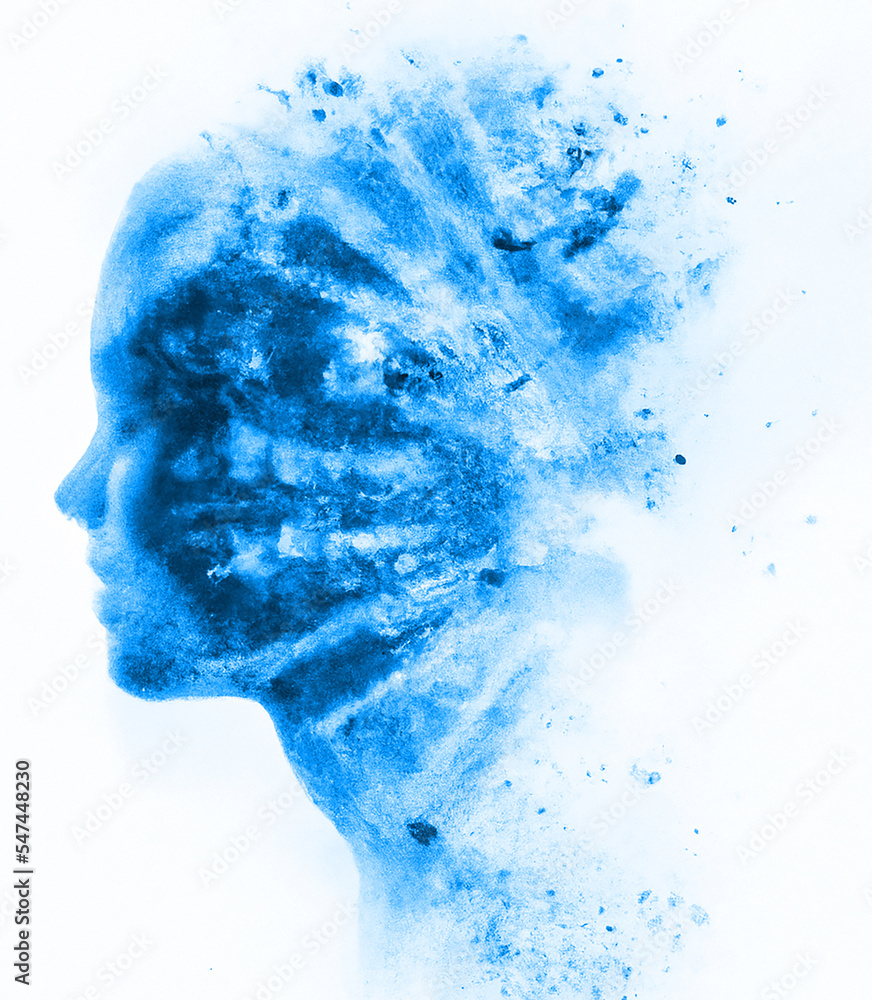 Face seen from the side. Brain problems. Degenerative disease. Bipolar ...