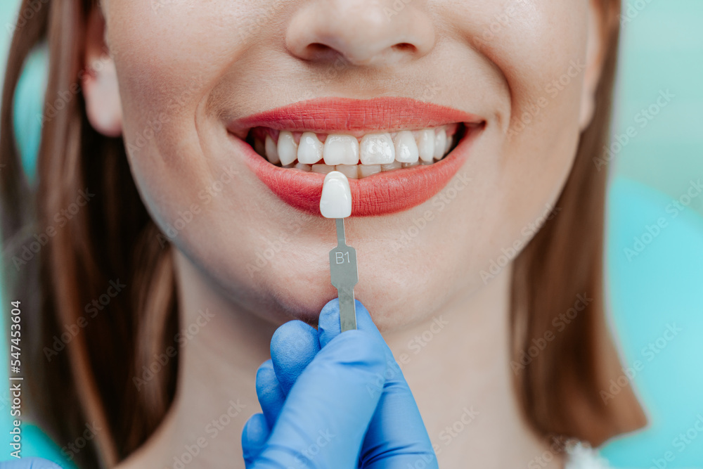 Smiling female mouth with natural white teeth in light blue background ...