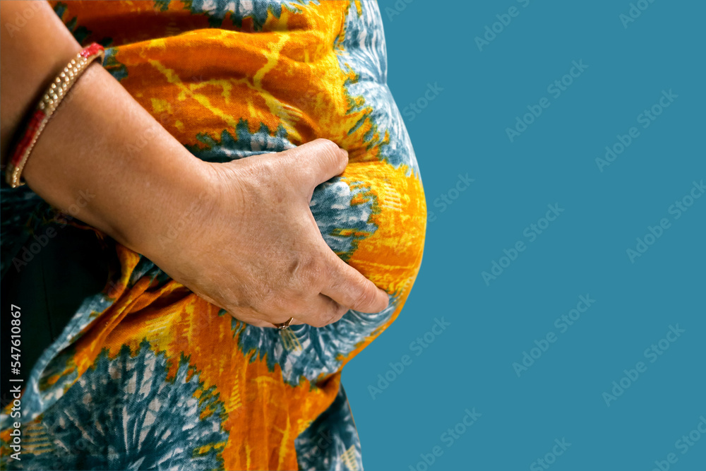 Obesity Concept, Obese Woman Holding His Belly Fat With Both Hands ...