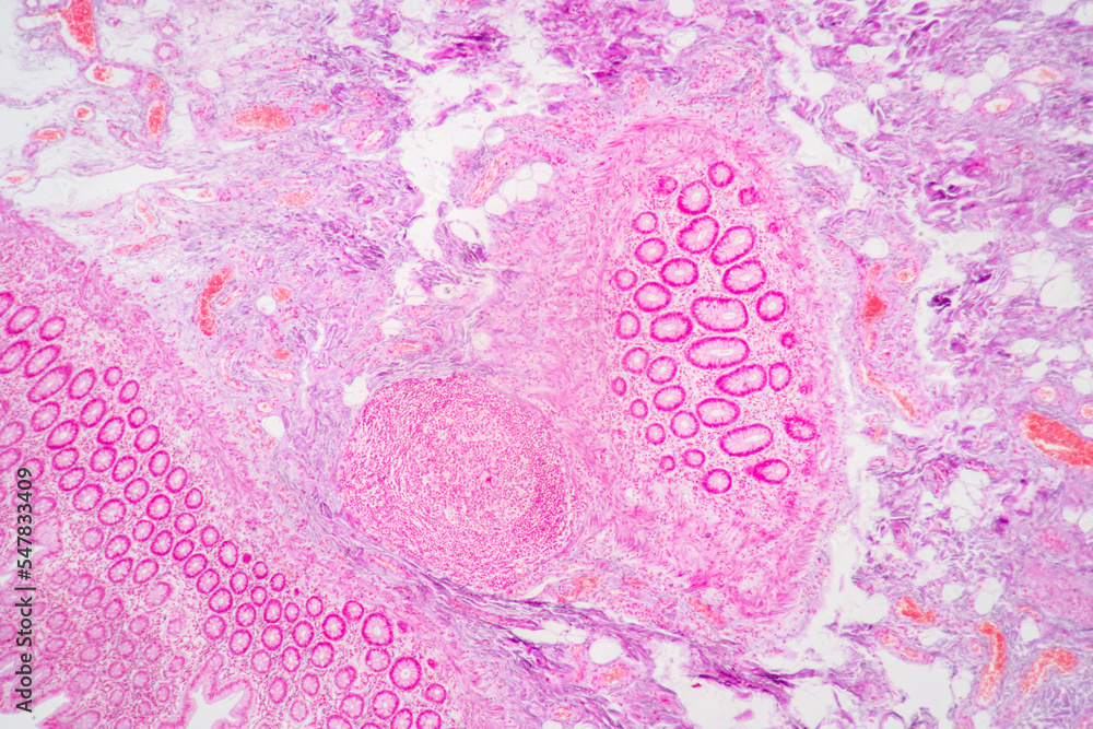 Backgrounds of Characteristics Tissue of Stomach Human, Small intestine ...