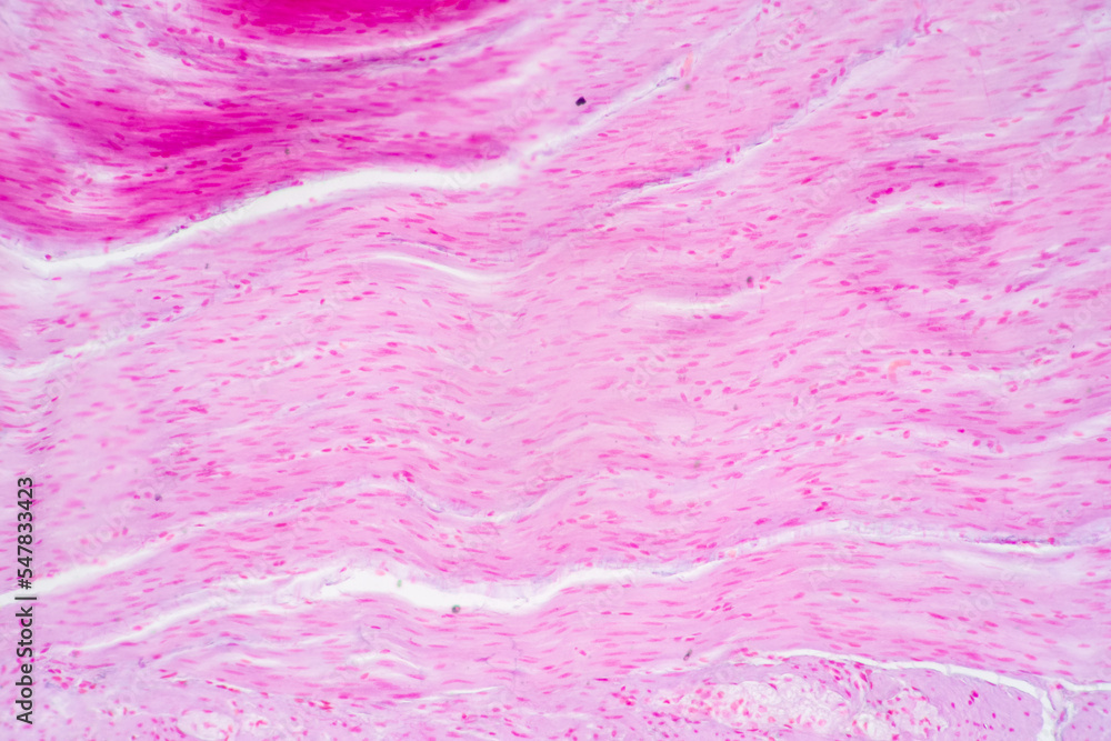 Backgrounds of Characteristics Tissue of Stomach Human, Small intestine ...