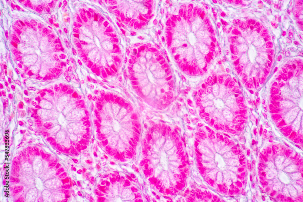 Backgrounds of Characteristics Tissue of Stomach Human, Small intestine ...