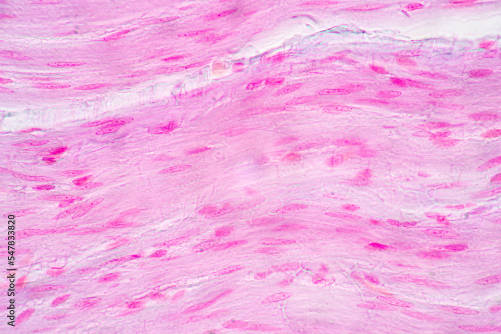 Backgrounds of Characteristics Tissue of Stomach Human, Small intestine ...