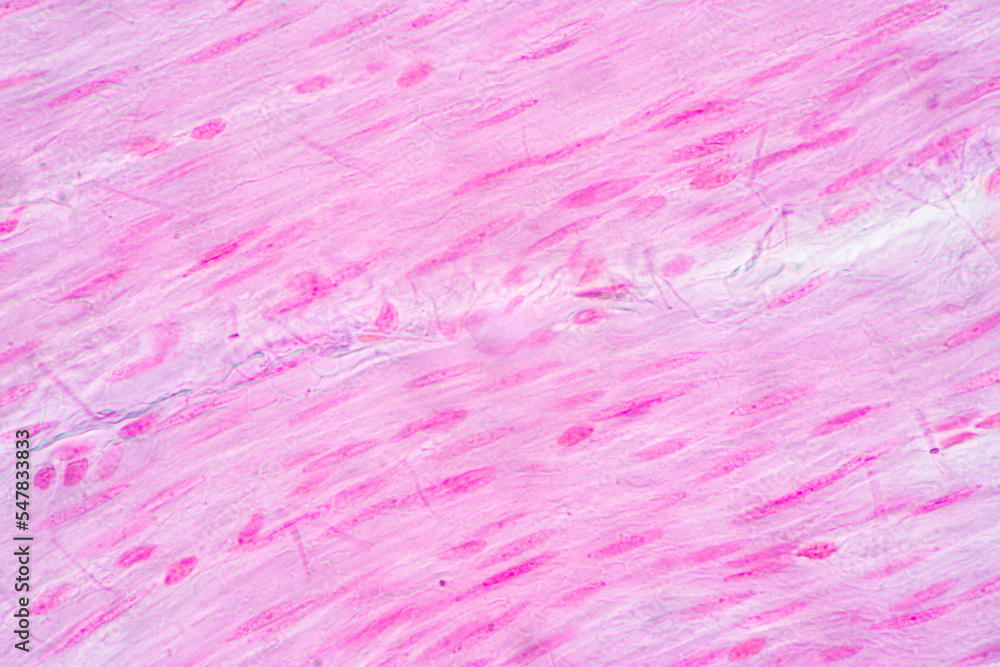 Backgrounds of Characteristics Tissue of Stomach Human, Small intestine ...