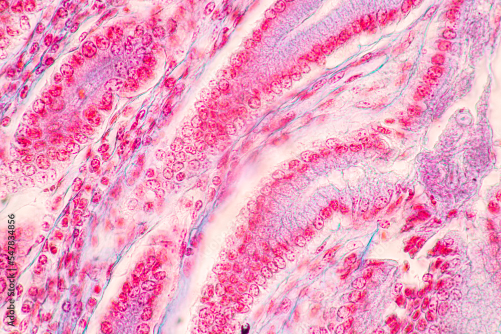 Backgrounds of Characteristics Tissue of Stomach Human, Small intestine ...