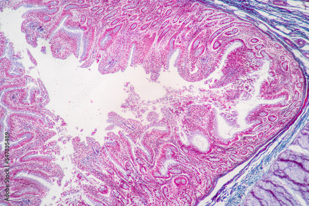 Backgrounds of Characteristics Tissue of Stomach Human, Small intestine ...