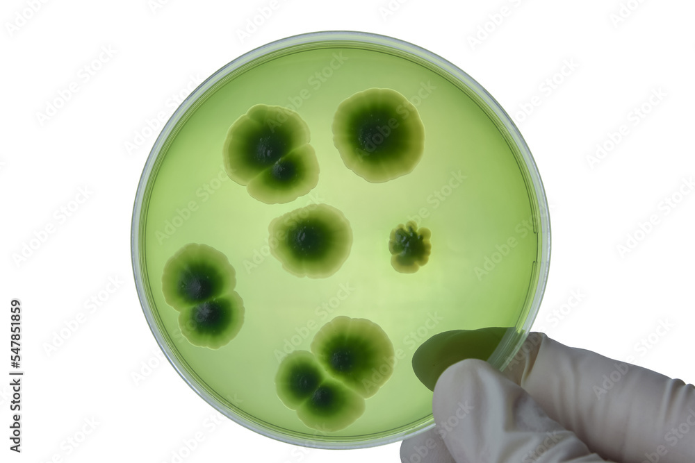 Hand with Petri dish or culture media with bacteria on white background ...