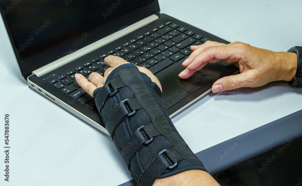 Freelancer woman with broken wrist is typing on laptop on keyboard ...