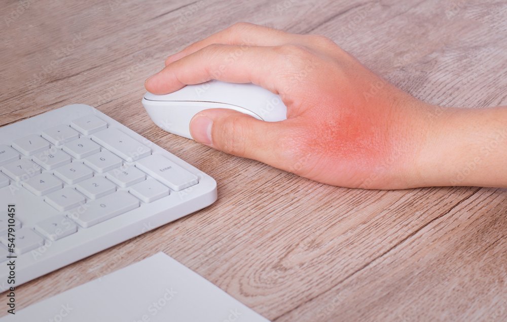 hand muscle inflammation from office syndrome , hand muscle pain Stock ...