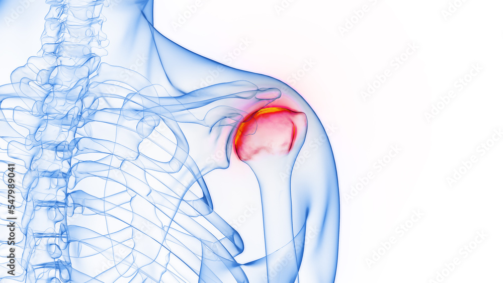 3D rendered Medical Illustration of Male Anatomy - Inflamed Shoulder ...