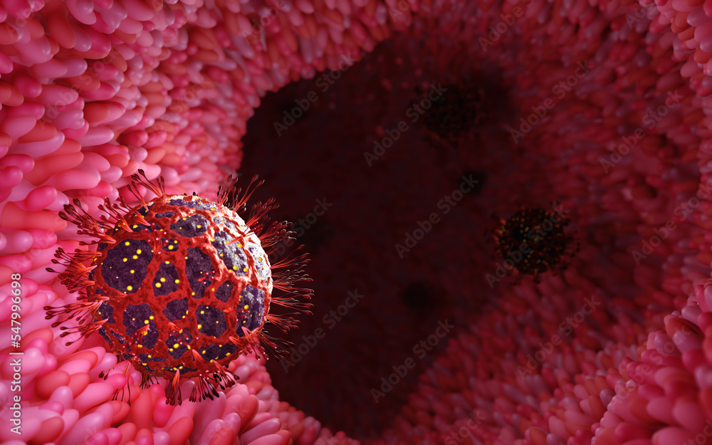 Small intestinal viral model. gastrointestinal disease caused by virus ...