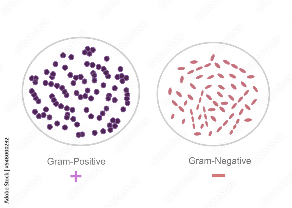 The interpretation result of gram-staining technique that showing Gram-Positive and Negative ...