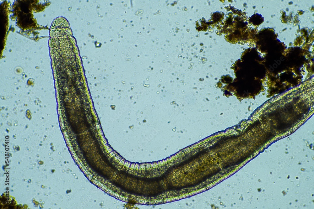 human parasites in the human gut Stock Photo | Adobe Stock