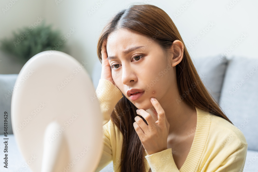 Expression worry asian young woman hand touching pustule around the ...