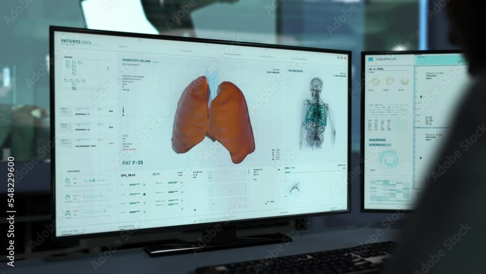 Computer For Medical Diagnosis Analysis Discovers Dangerous Cancer ...