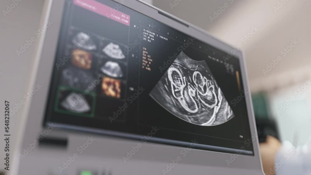 Examining the foetus health during the child scan procedure at the ...