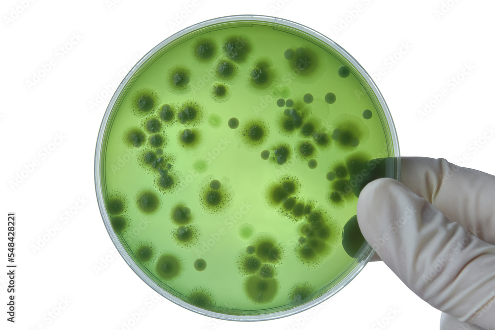 Hand with Petri dish or culture media with bacteria on white background ...