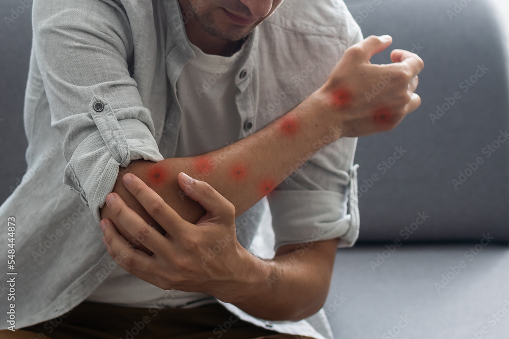 red spots on the hands Stock Photo | Adobe Stock
