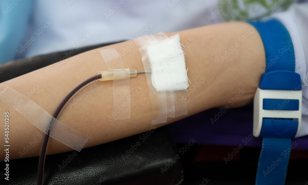 Close up arm of female donor giving blood at donation center, Blood ...