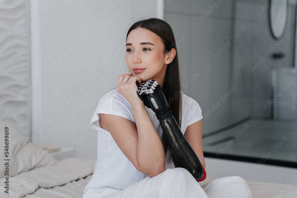 Beautiful Italian brunette girl with carbon fiber limb leaning on ...