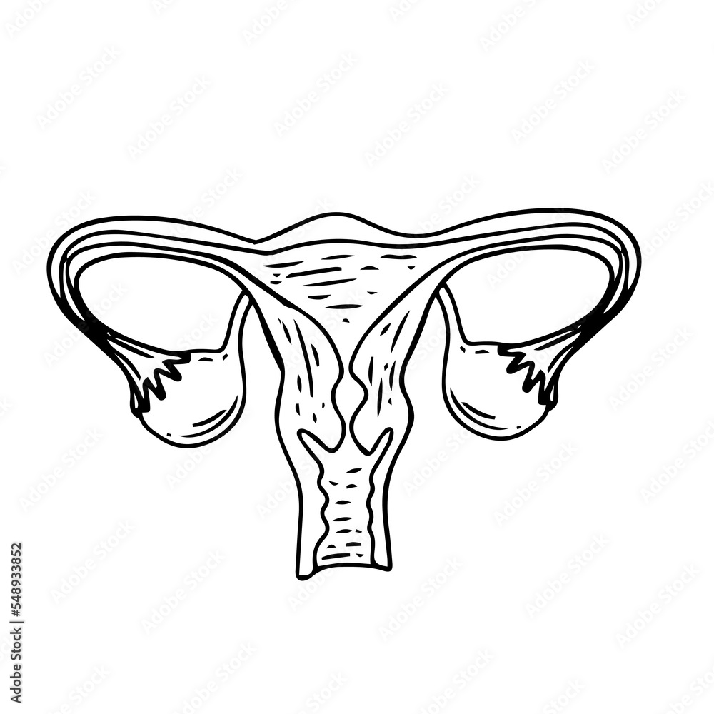 Women Health Floral Infographic Of Polycystic Ovary Syndrome Patient
