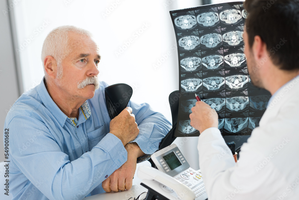 doctor discussing x-ray scans of elderly male patient Stock Photo ...