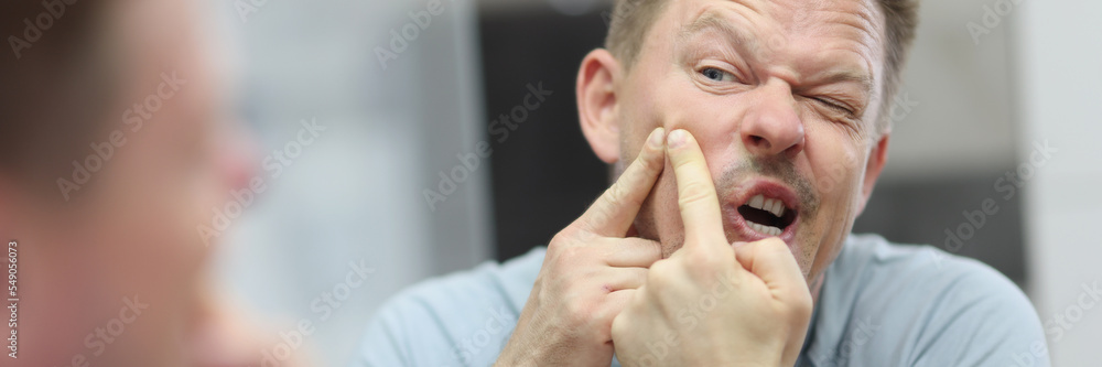 Man squeeze and get rid of pimple on face looking in mirror Stock Photo ... Man squeeze and get rid of pimple on face looking in mirror Stock Photo ...