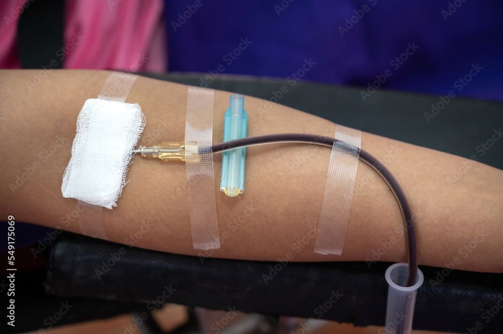 Close up arm of female donor giving blood at donation center, Blood ...
