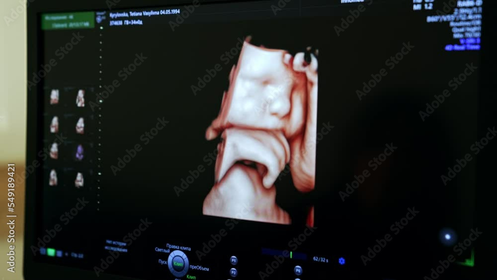 Little baby face and hands on the black screen of ultrasound equipment ...