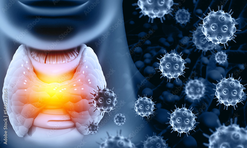 Virus infected thyroid gland. 3d illustration Stock Illustration ...