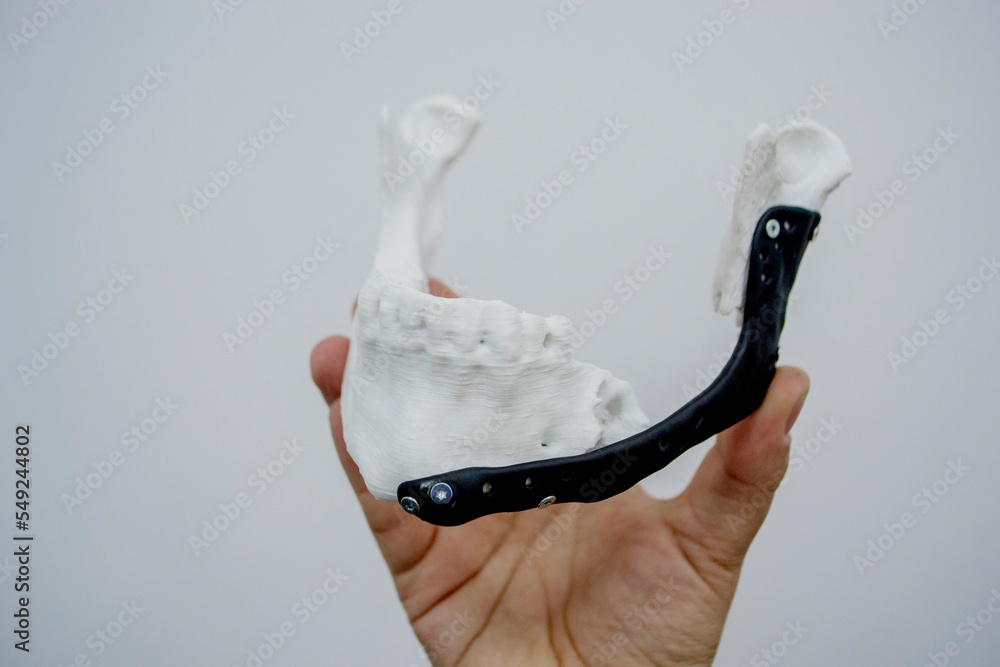 Person holding in hand 3D printed plastic prototype human lower jaw and ...
