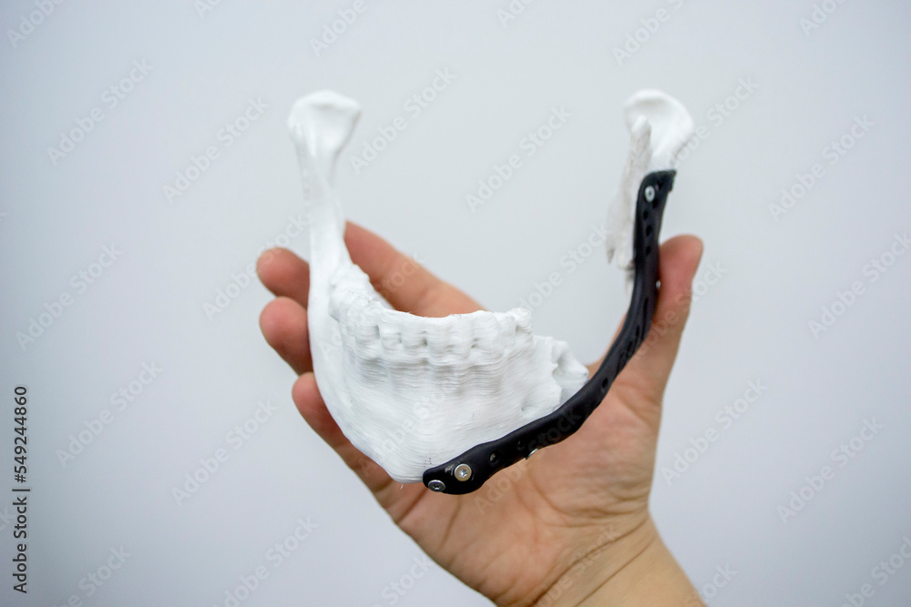 Person holding in hand 3D printed plastic prototype human lower jaw and ...