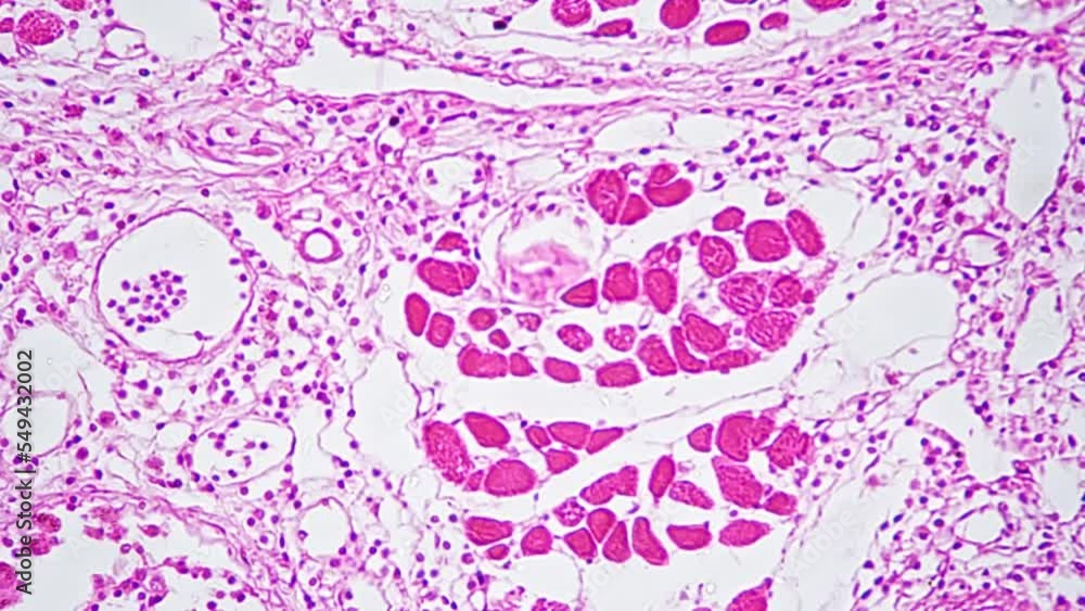 Longitudinal section of human lung filmed under microscope 400x against ...
