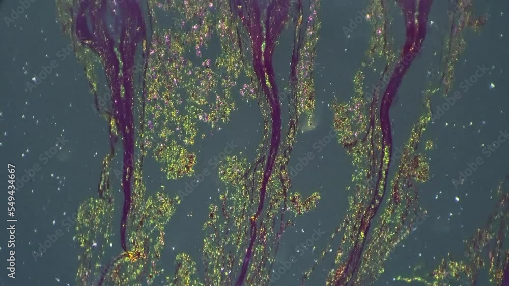 Human lung tissues filmed under microscope 200x with oblique ...