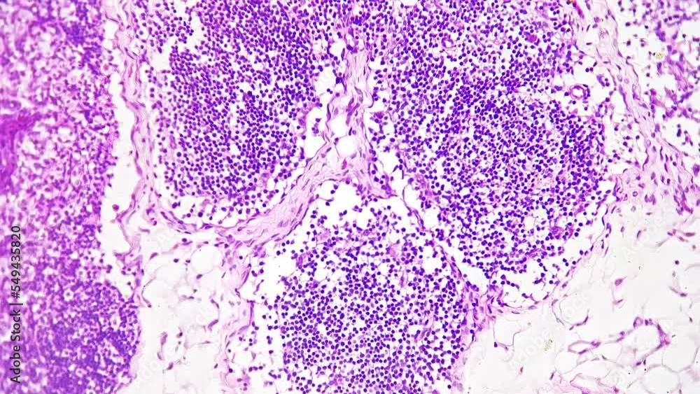 Lymph node in section magnified under microscope 200x on bright field ...