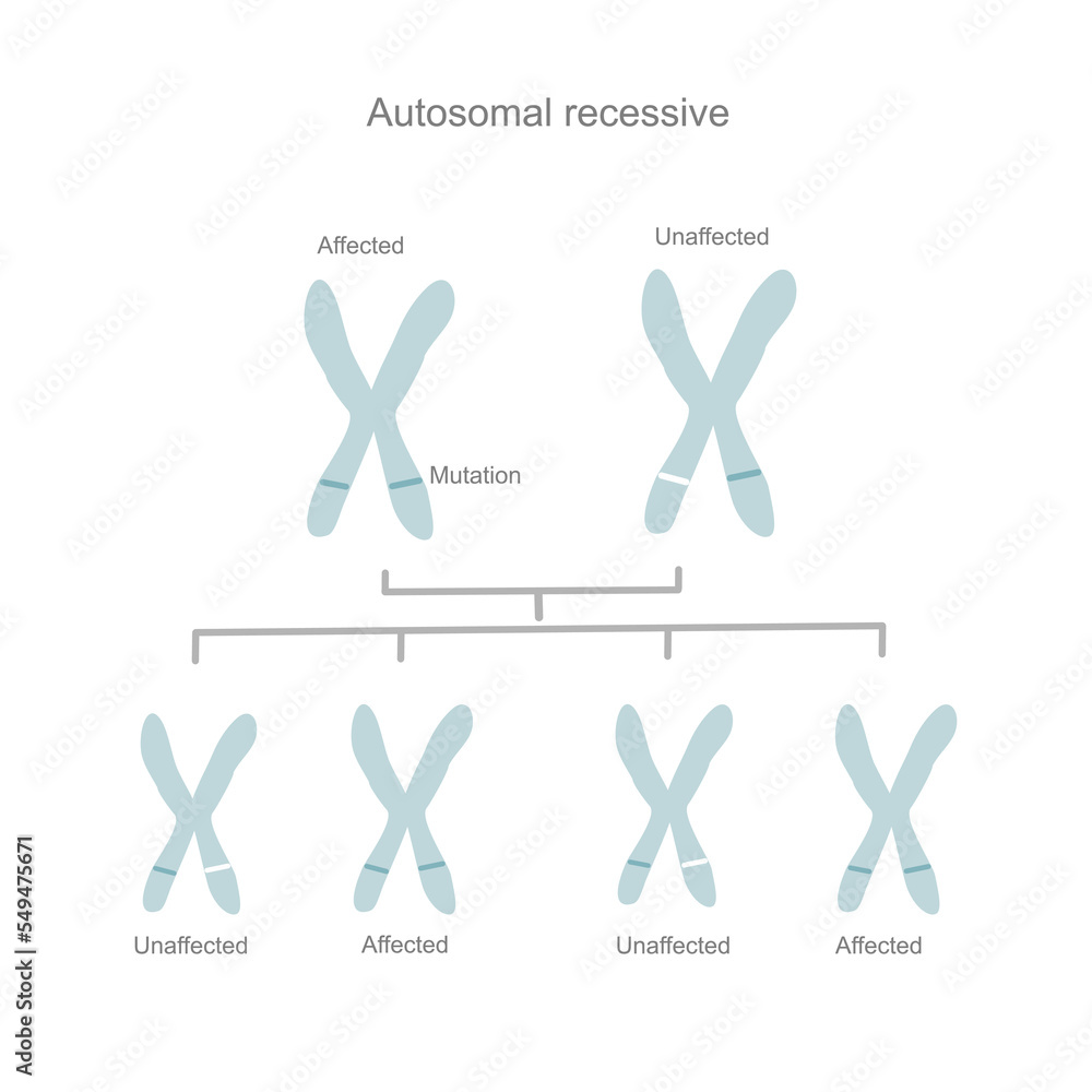 The autosomal recessive diagram or inheritance pattern that inheriting ...