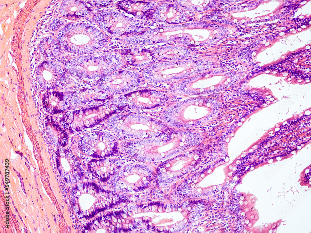 small intestine cross section under the microscope - optical microscope ...