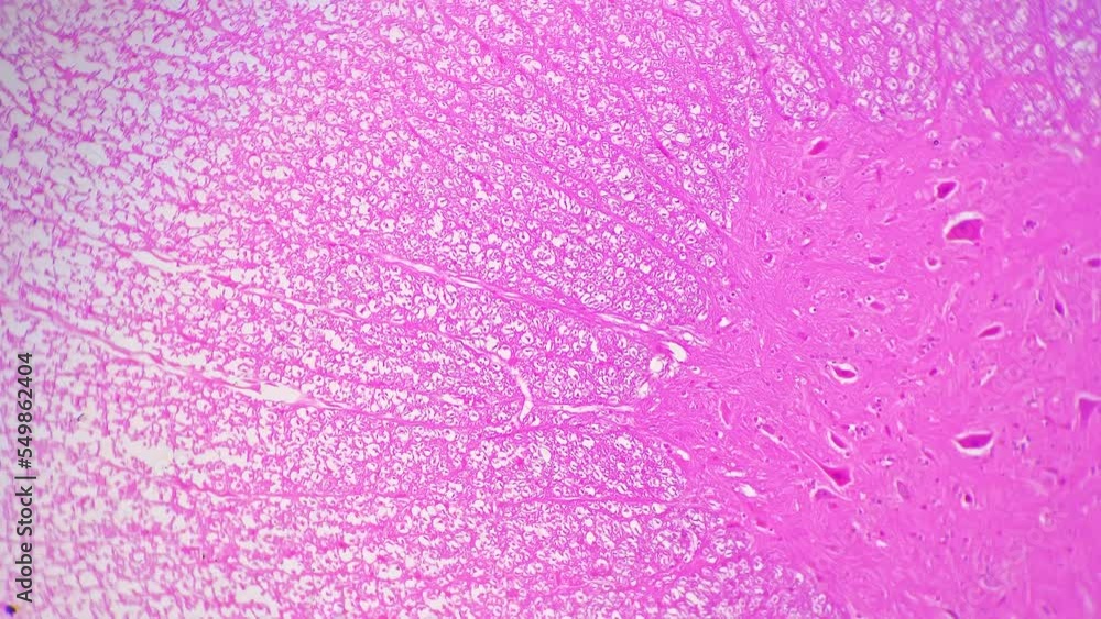 Spinal cord cell TS microscopic sample 100x magnification tinted pink ...