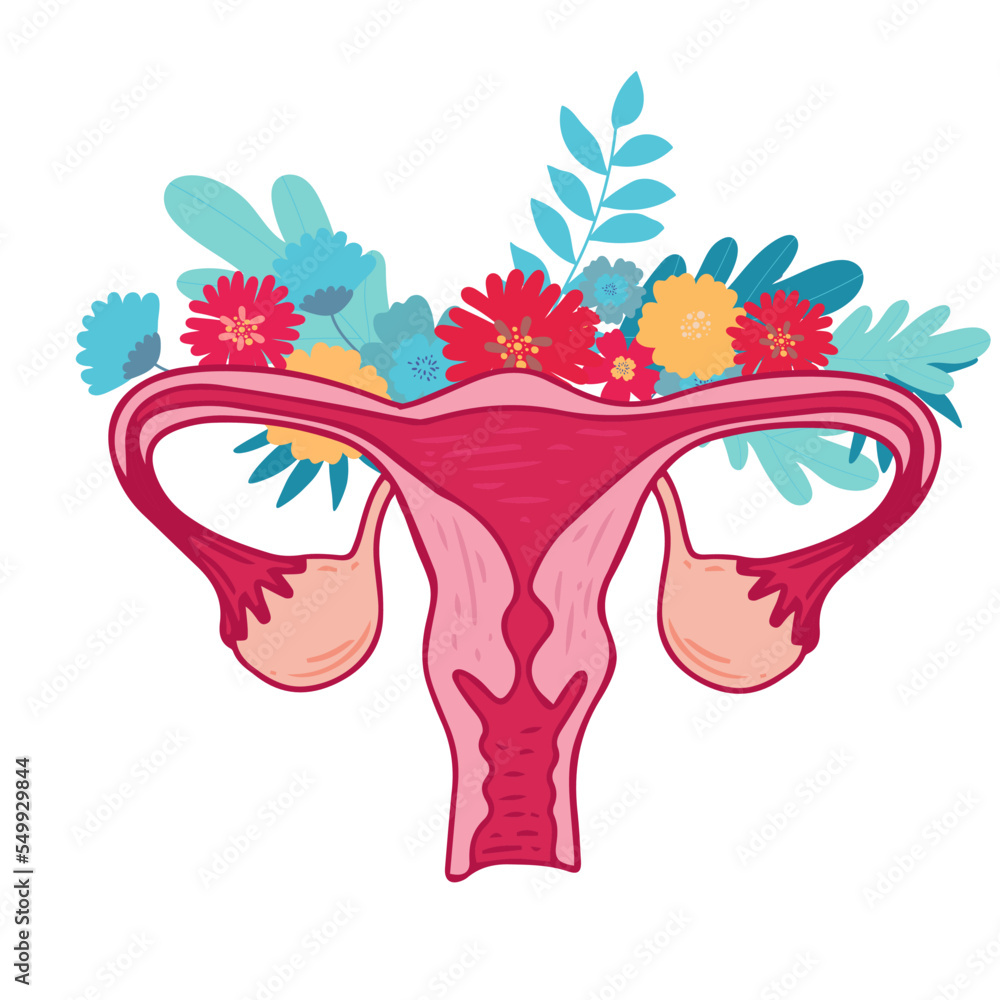 Women health - Floral Infographic of Polycystic ovary syndrome. Patient ...
