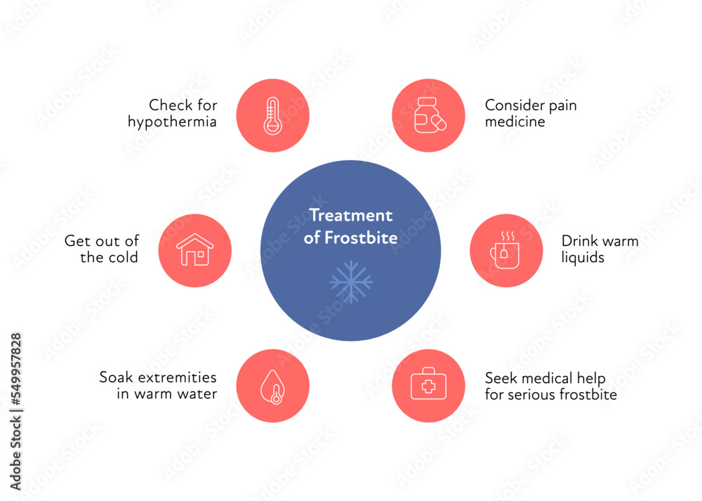 Frostbite and hypothermia health care infographic collection. Vector ...