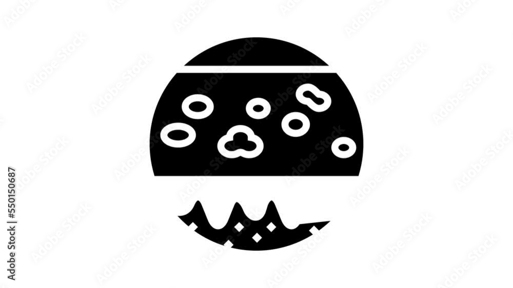 skin rashes hiv symptom glyph icon animation vídeo de Stock | Adobe Stock skin rashes hiv symptom glyph icon animation vídeo de Stock | Adobe Stock