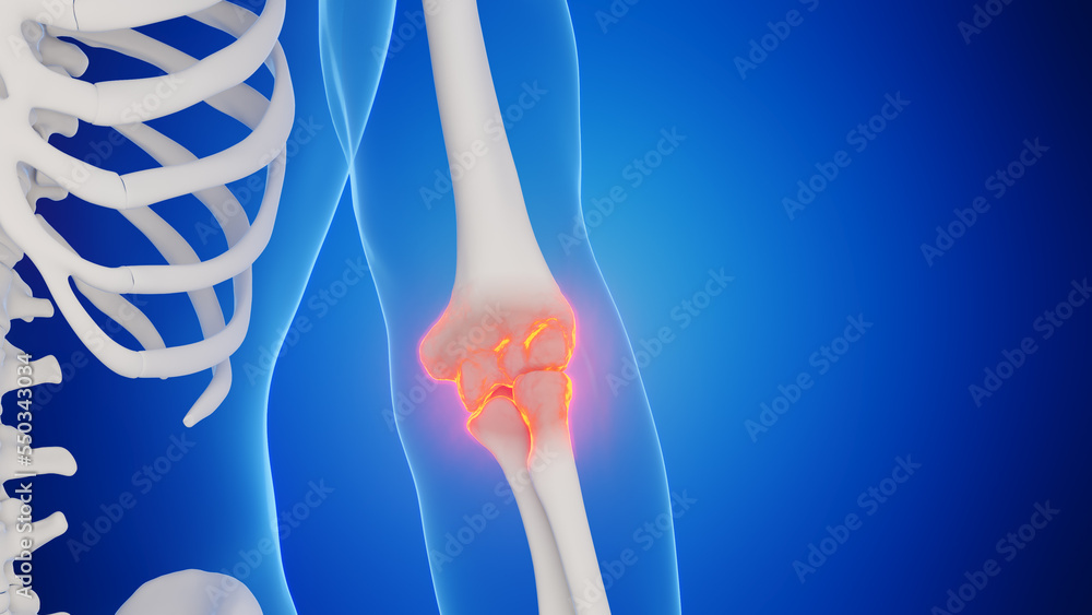 3d rendered medical illustration of a man's elbow joint Stock ...