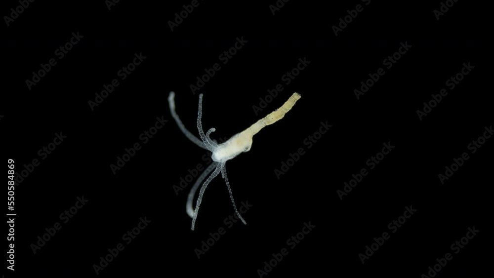 Cnidaria polyp under a microscope. It has tentacles with stinging cells ...