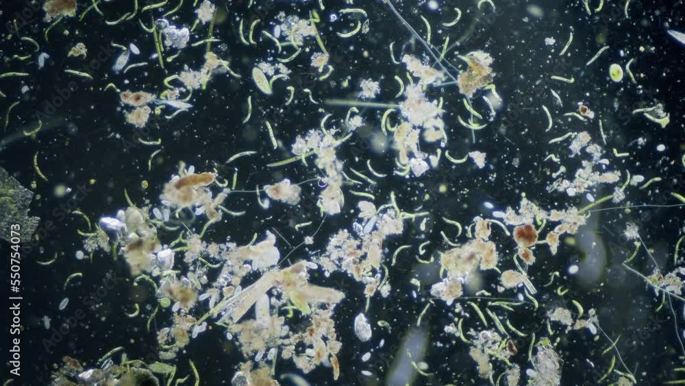 Different freshwater species of protozoa single cell organisms as ...